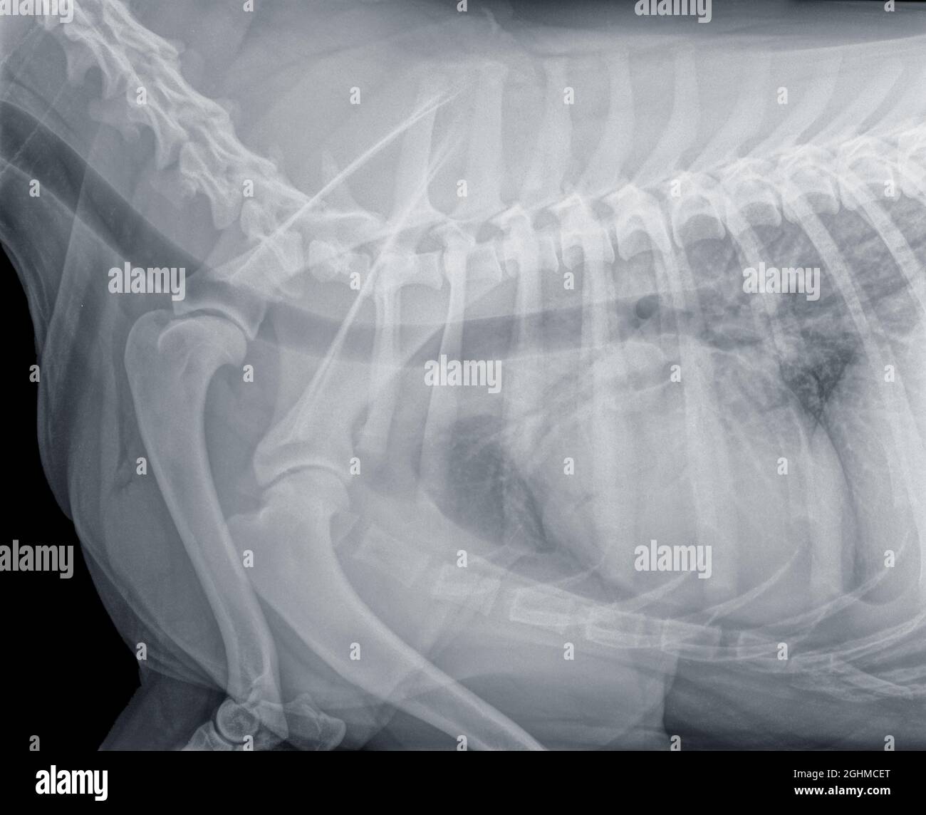 Radiografia delle costole immagini e fotografie stock ad alta ...