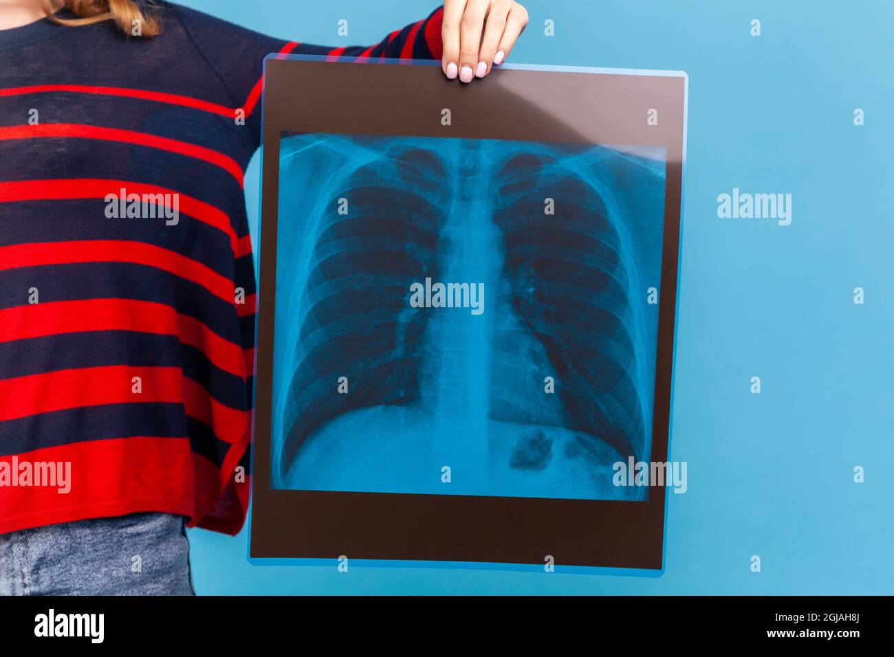 Problemi respiratori. Donna senza volto indossando a strisce stile ...