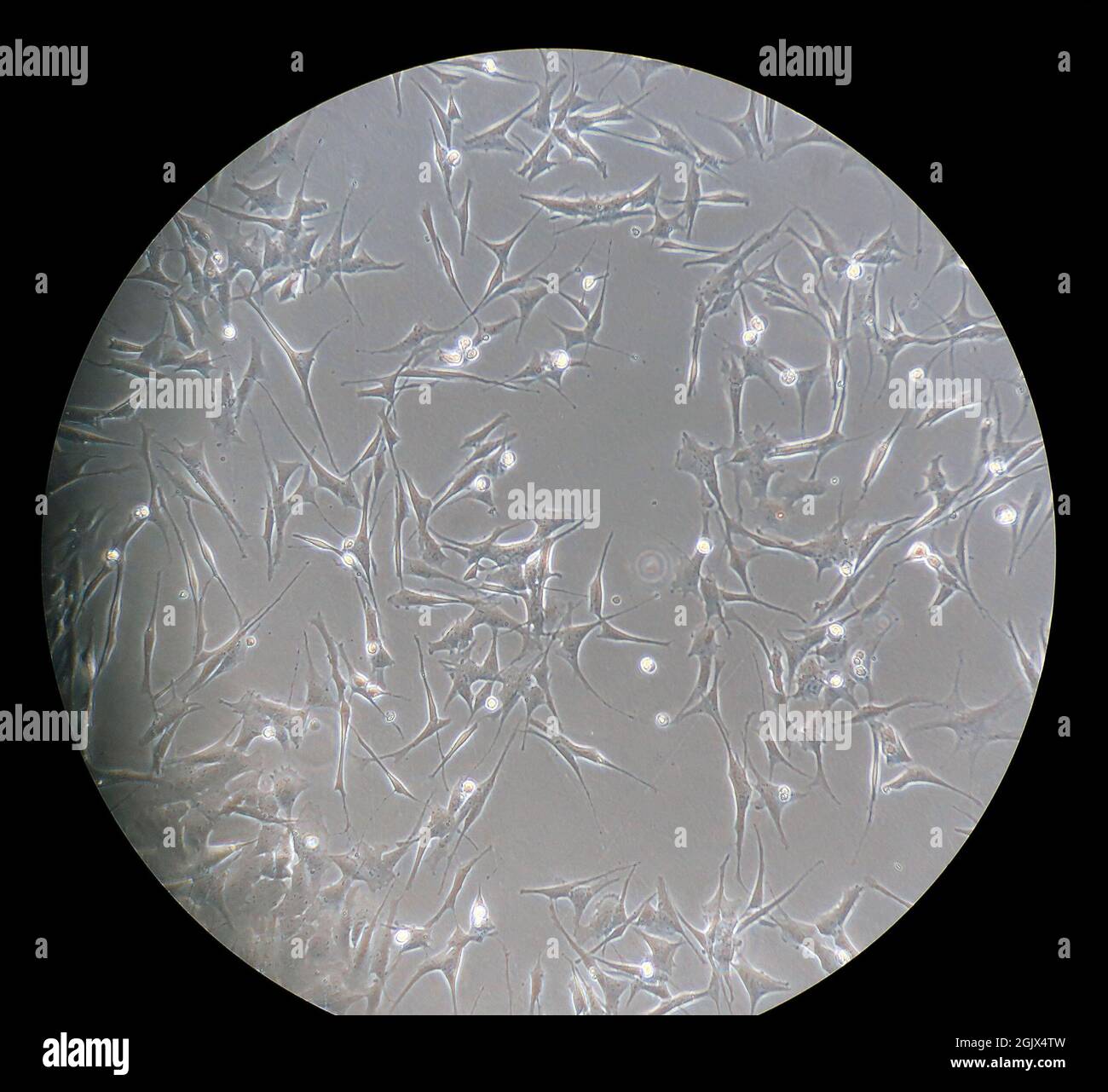 Cellule al microscopio immagini e fotografie stock ad alta risoluzione ...