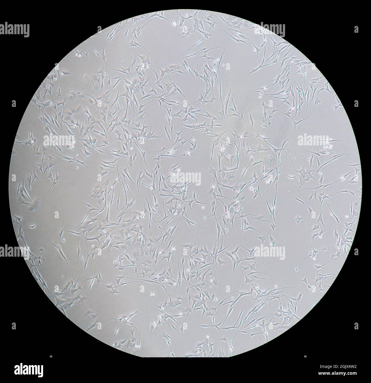 Cellule al microscopio immagini e fotografie stock ad alta risoluzione ...