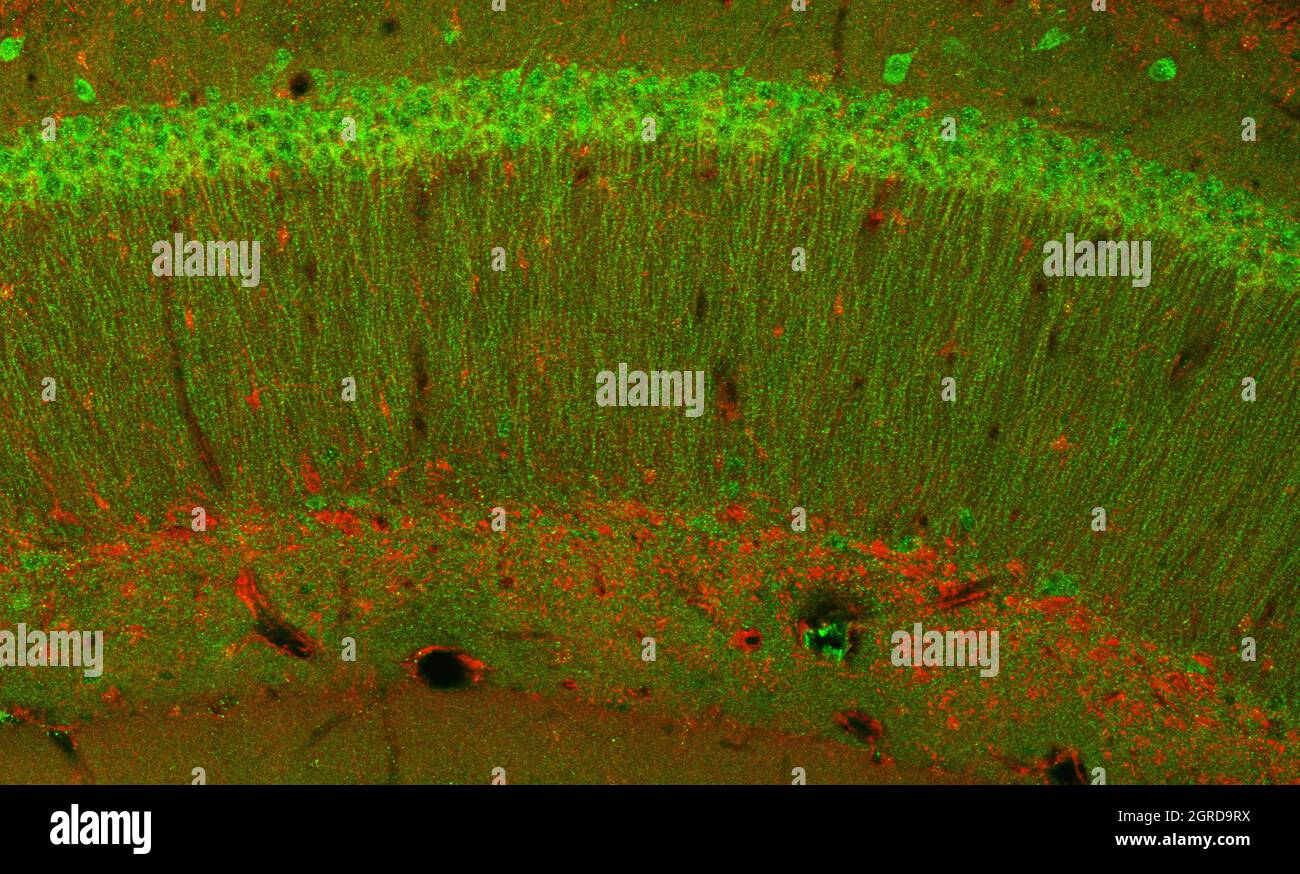Corteccia cerebrale e parte dell'ippocampo sotto di essa in una sezione ...