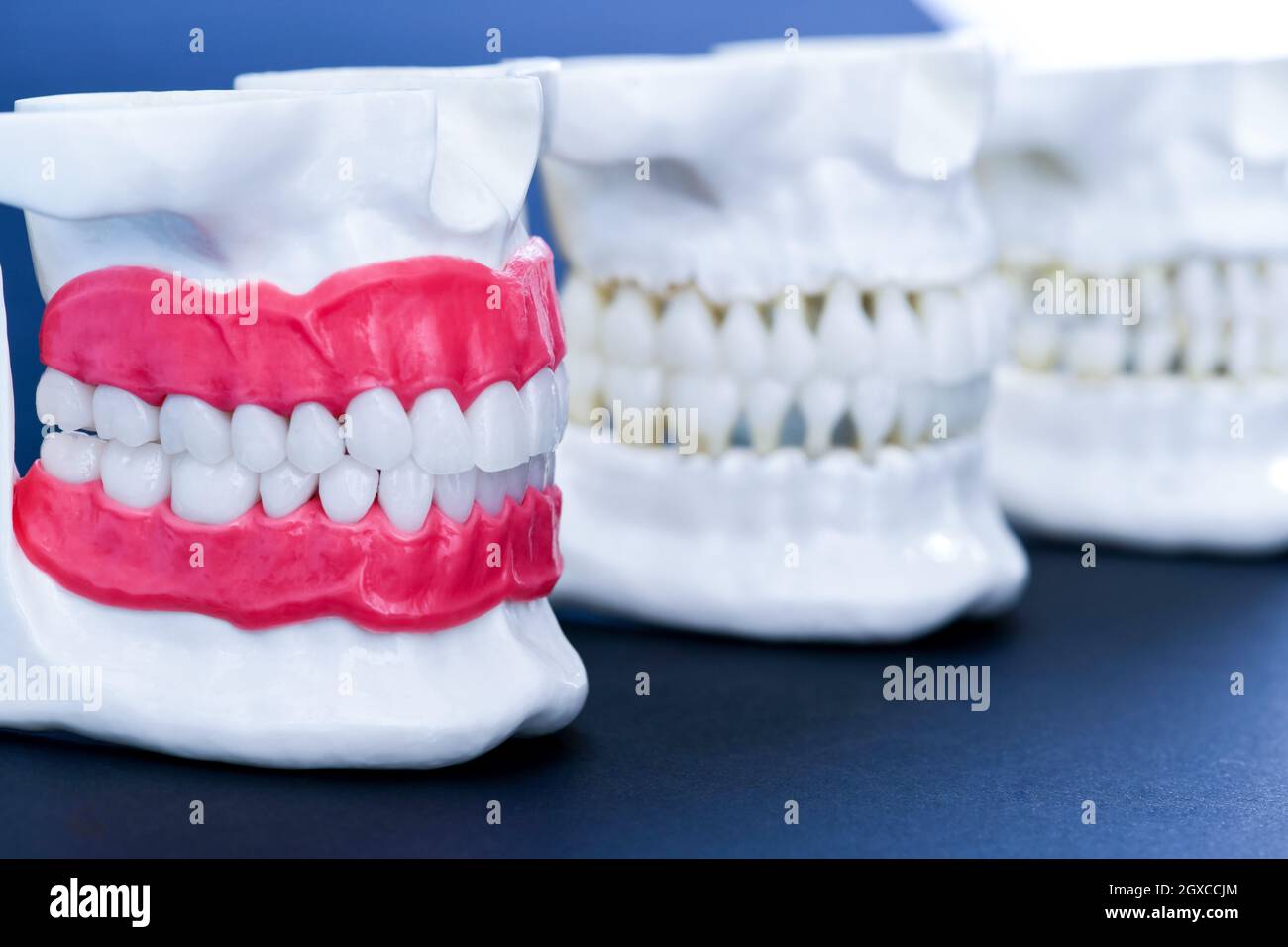 Ganasce umana con denti e gengive modelli anatomia Illustrazione medica ...