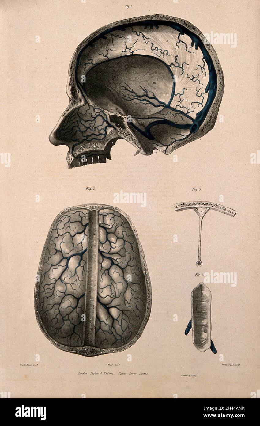 Vene cerebrali immagini e fotografie stock ad alta risoluzione - Alamy