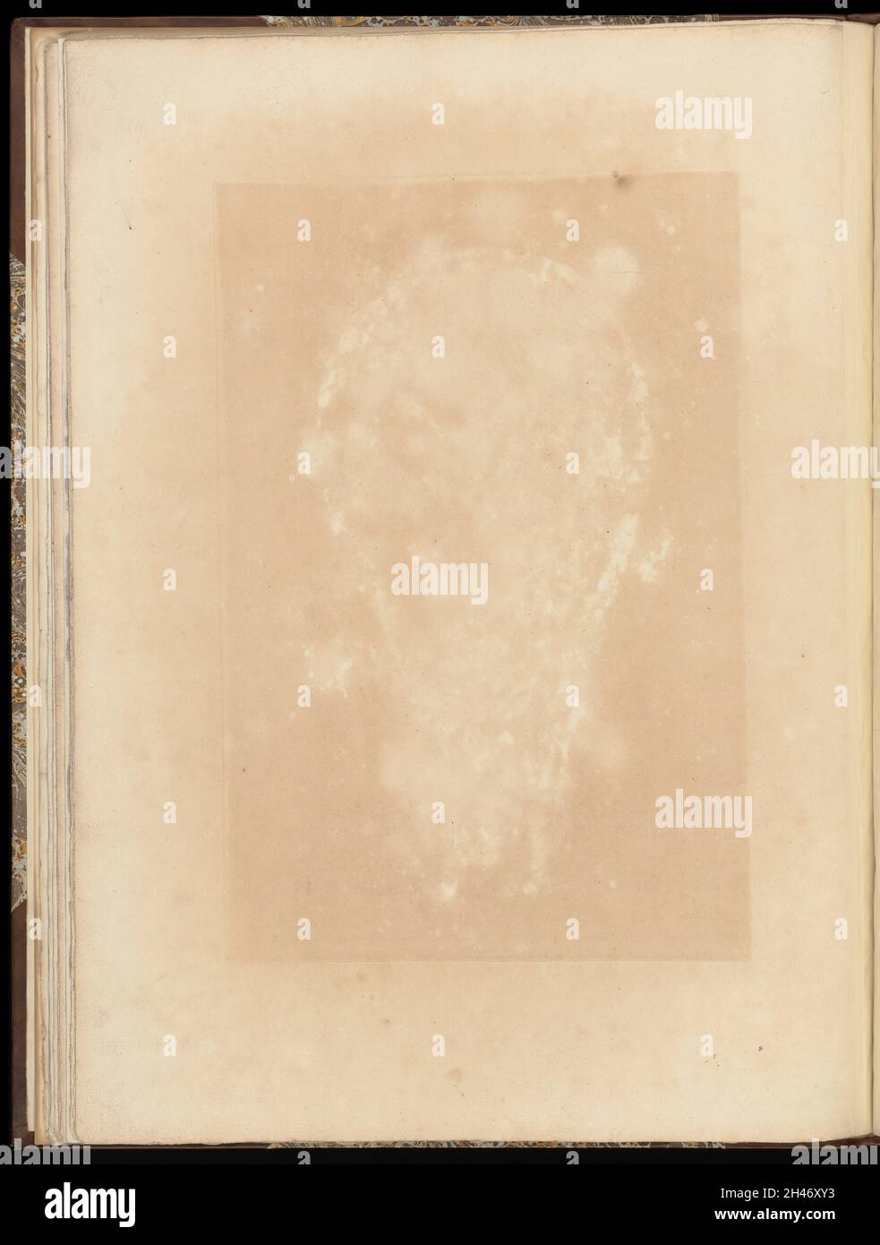 Anatomia dell'utero gravido umano immagini e fotografie stock ad alta ...