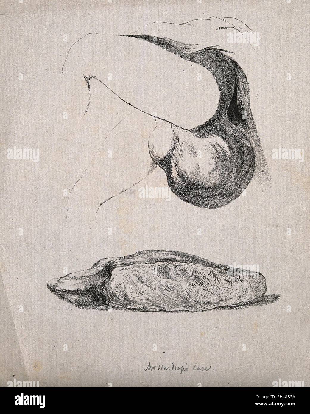 Scroto uomo immagini e fotografie stock ad alta risoluzione - Alamy