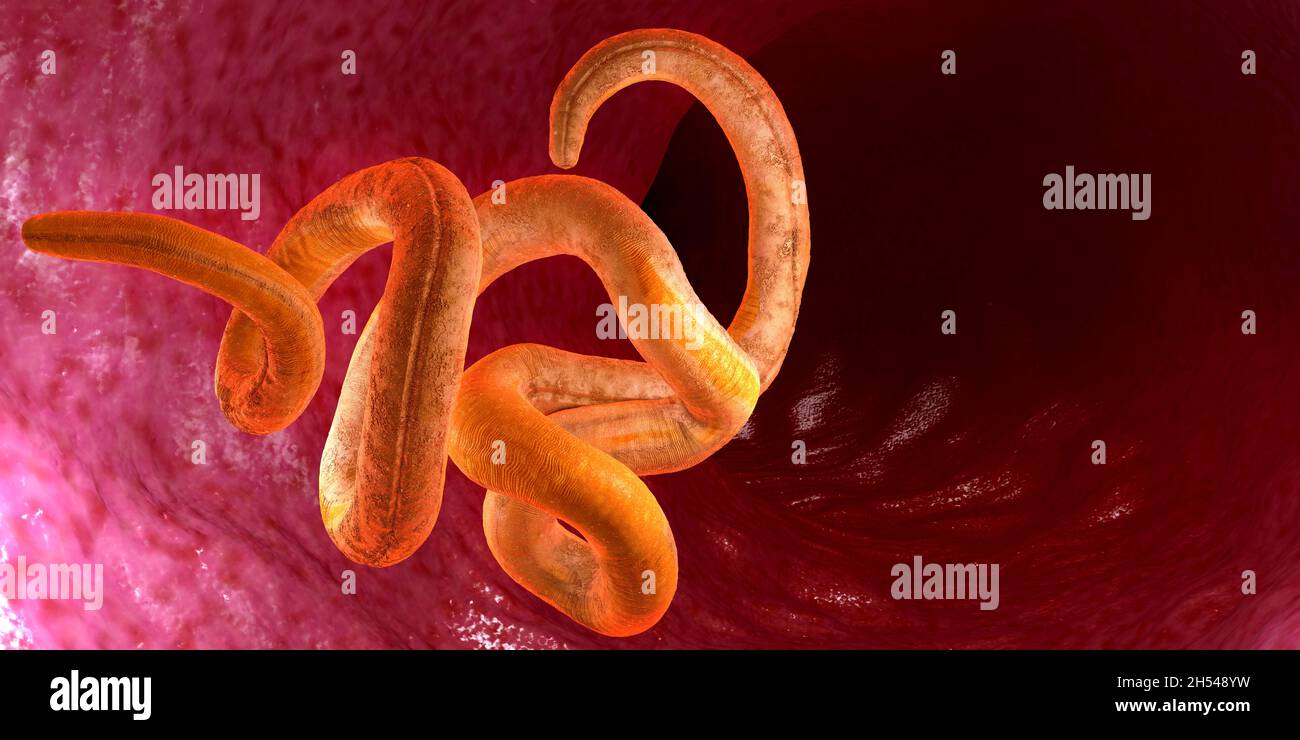 Vermi intestinali immagini e fotografie stock ad alta risoluzione - Alamy