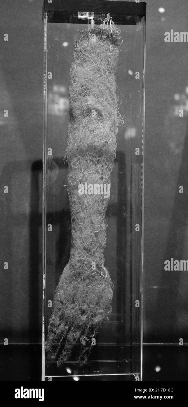 Anatomia delle vene Foto e Immagini Stock in Bianco e Nero - Alamy