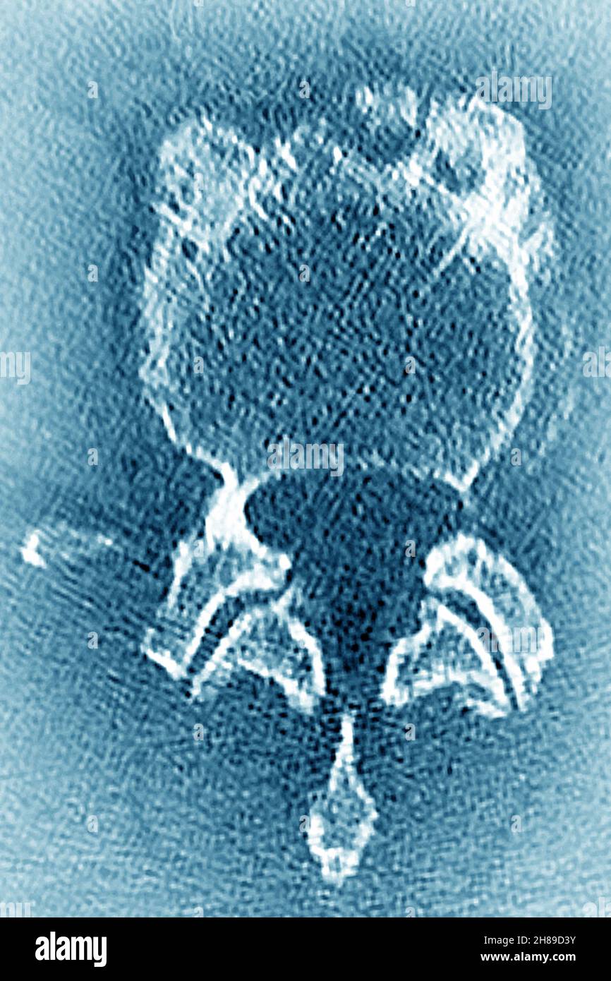 Mri della colonna lombare immagini e fotografie stock ad alta ...