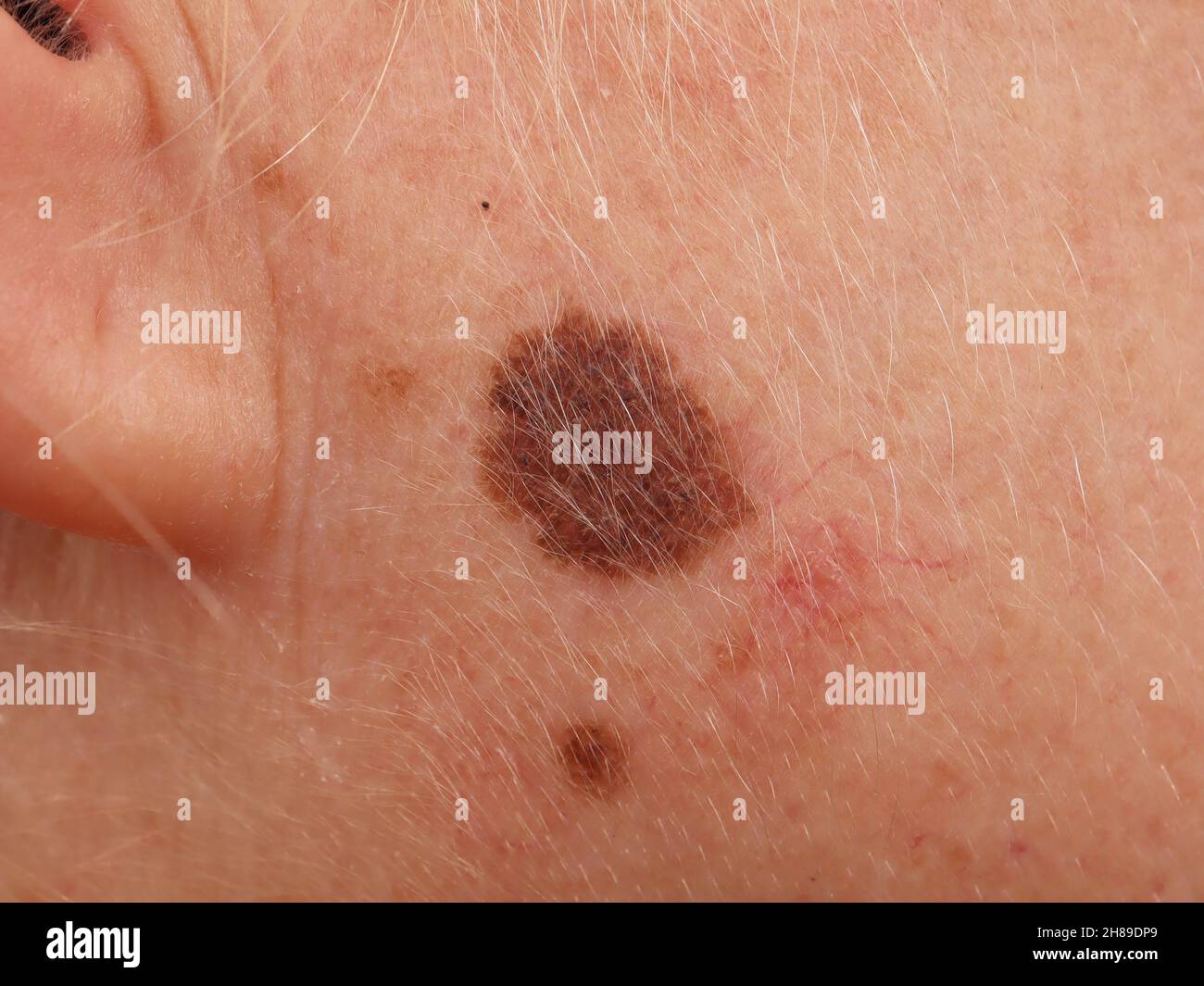 Nevo nevocitario immagini e fotografie stock ad alta risoluzione - Alamy