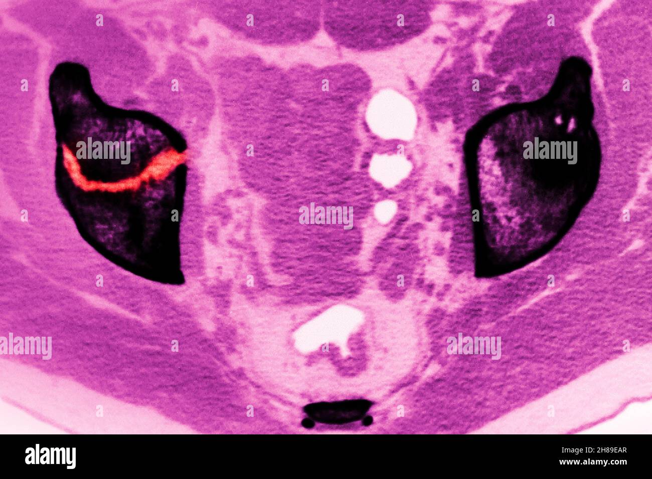 Sistema muscolare assiale immagini e fotografie stock ad alta ...