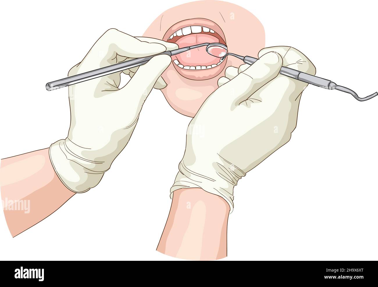 Radiografia dello stomatologo Immagini Vettoriali Stock - Alamy
