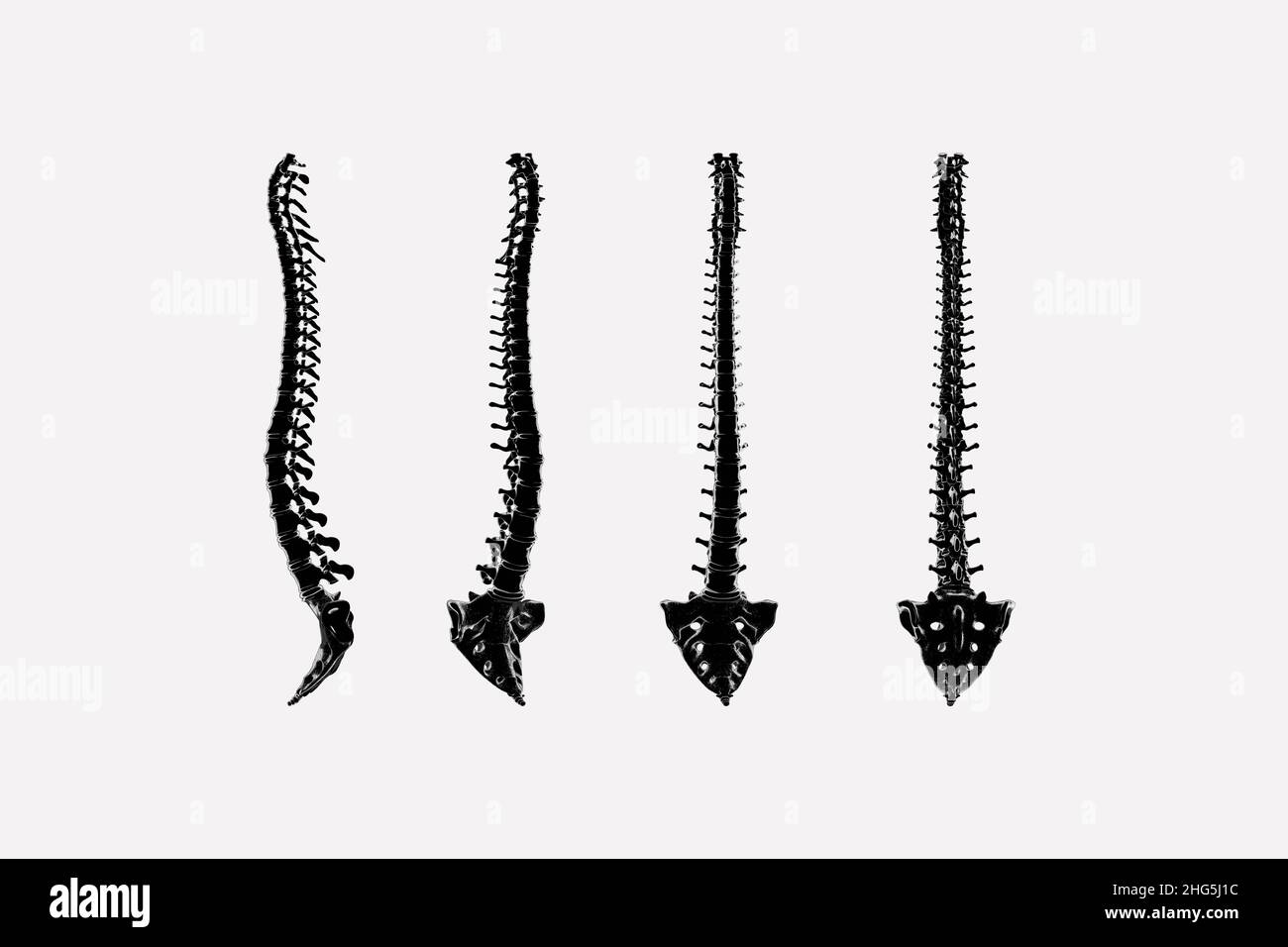 Vertebrale spina dorsale spinale immagini e fotografie stock ad alta ...