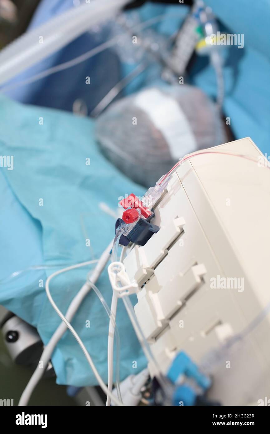 Anestesia generale immagini e fotografie stock ad alta risoluzione - Alamy