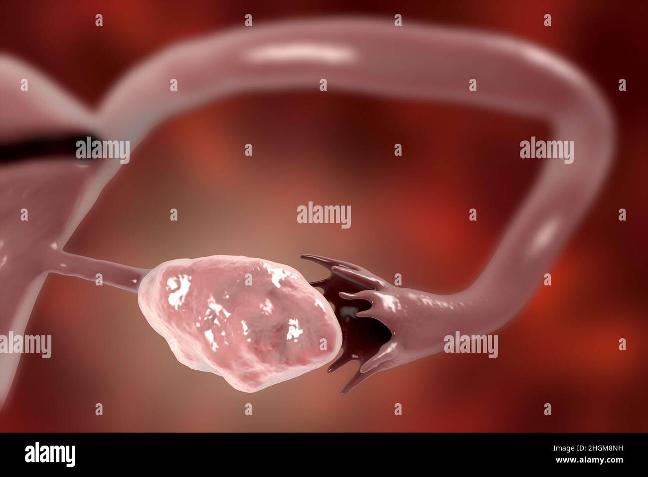 Ovaie anatomy immagini e fotografie stock ad alta risoluzione - Alamy