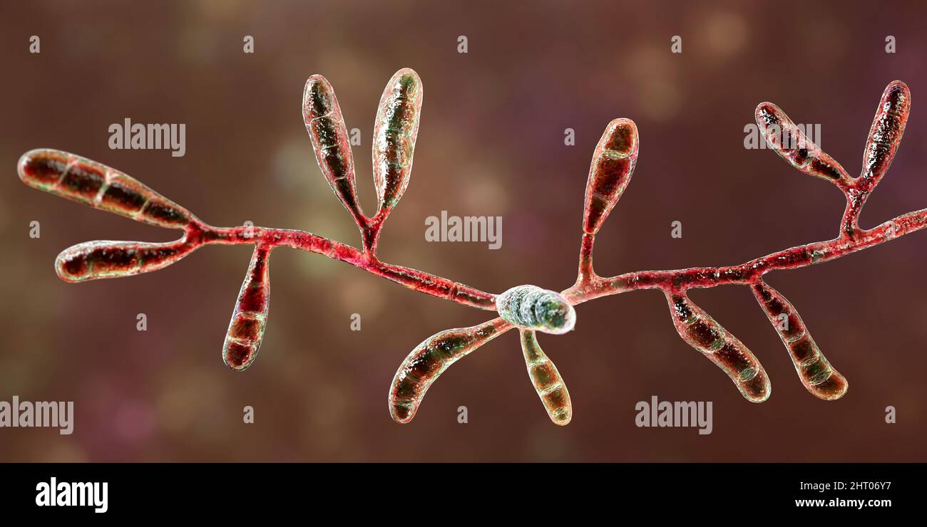 Epidermophyton floccosum immagini e fotografie stock ad alta ...