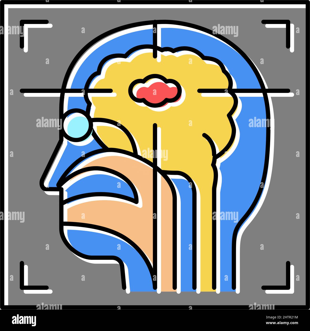 Radiologia e medicina nucleare Immagini Vettoriali Stock - Alamy