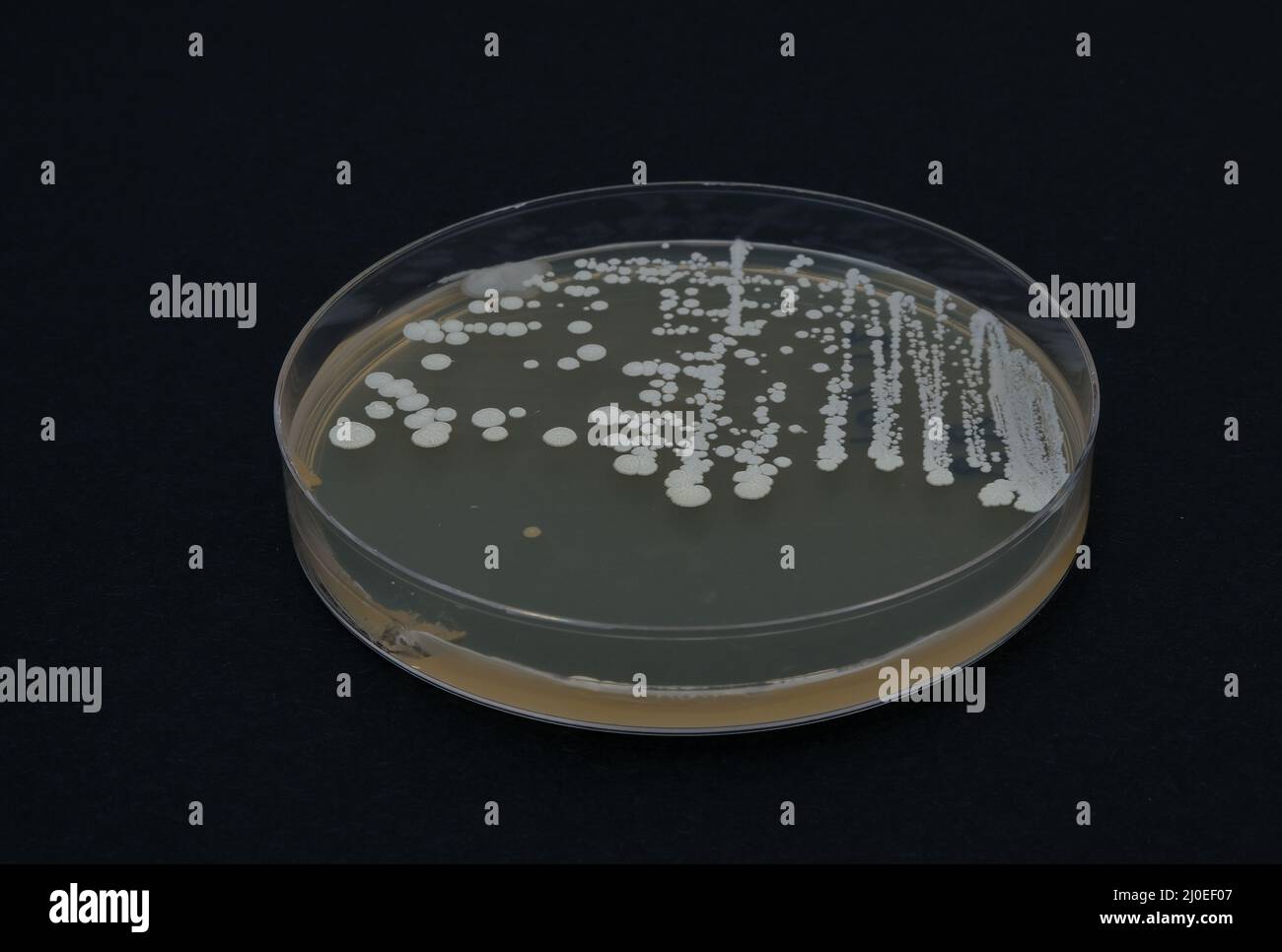 Agar nutriente immagini e fotografie stock ad alta risoluzione - Alamy