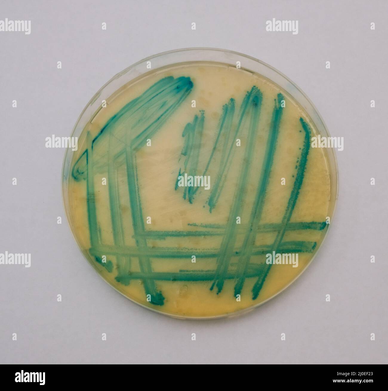 Nutrient agar immagini e fotografie stock ad alta risoluzione - Alamy