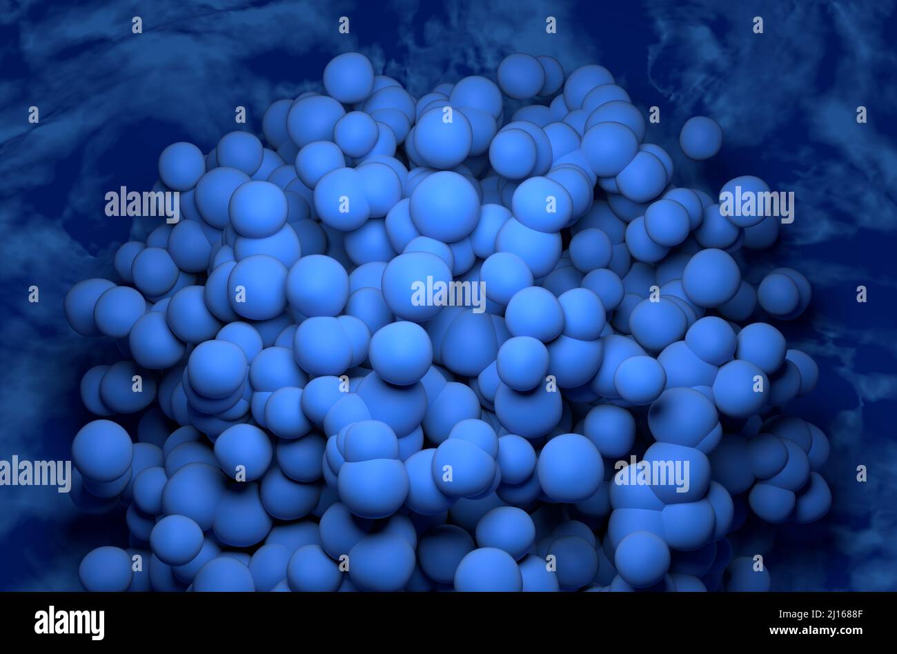 Glioblastoma multiforme immagini e fotografie stock ad alta risoluzione ...