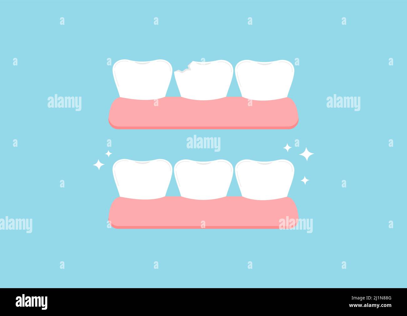 Lesioni gengivali immagini e fotografie stock ad alta risoluzione - Alamy