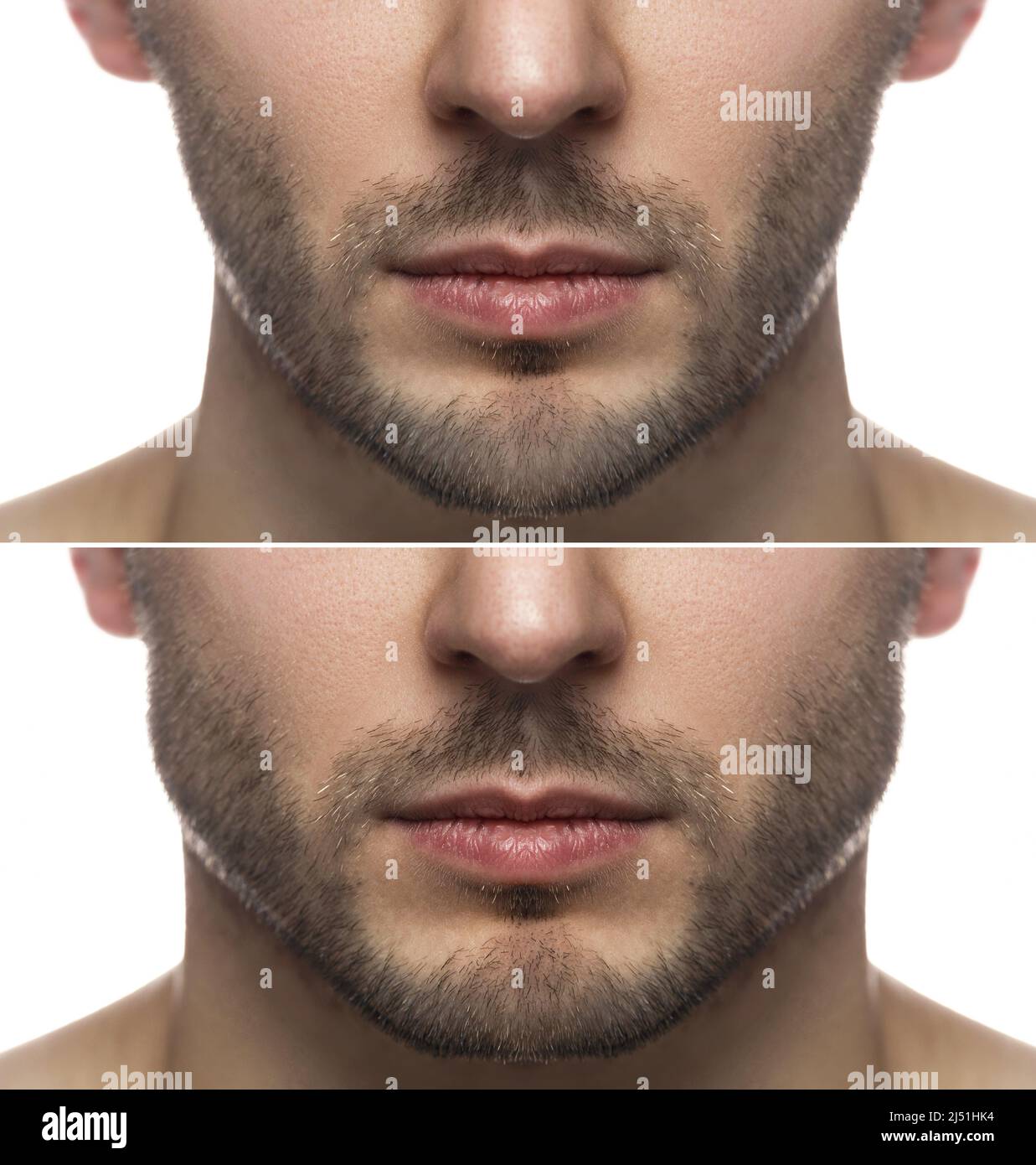 Esercizi del doppio mento immagini e fotografie stock ad alta ...