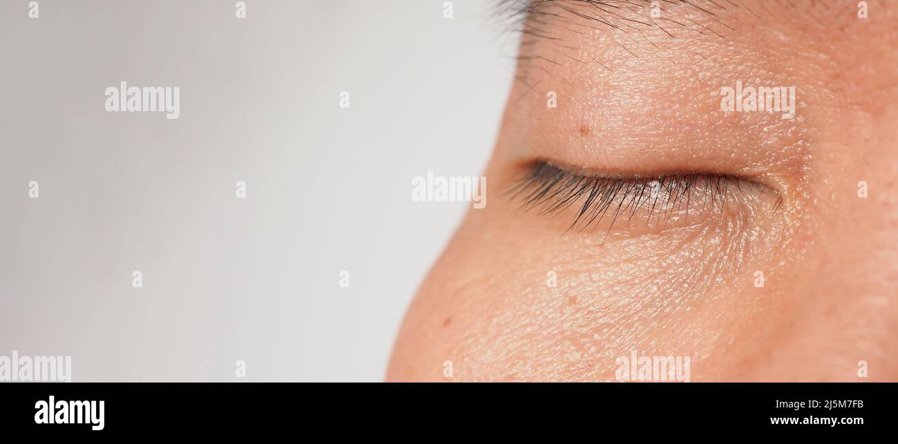 Pelle di verruca immagini e fotografie stock ad alta risoluzione ...