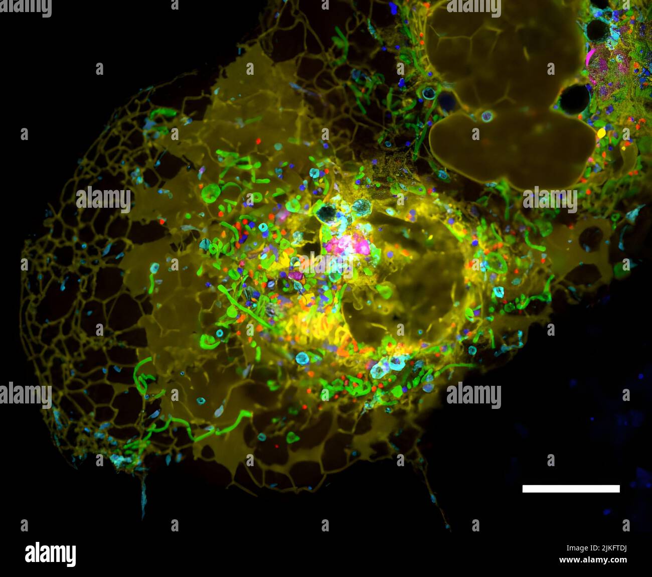 Apparato di golgi microscopio immagini e fotografie stock ad alta ...