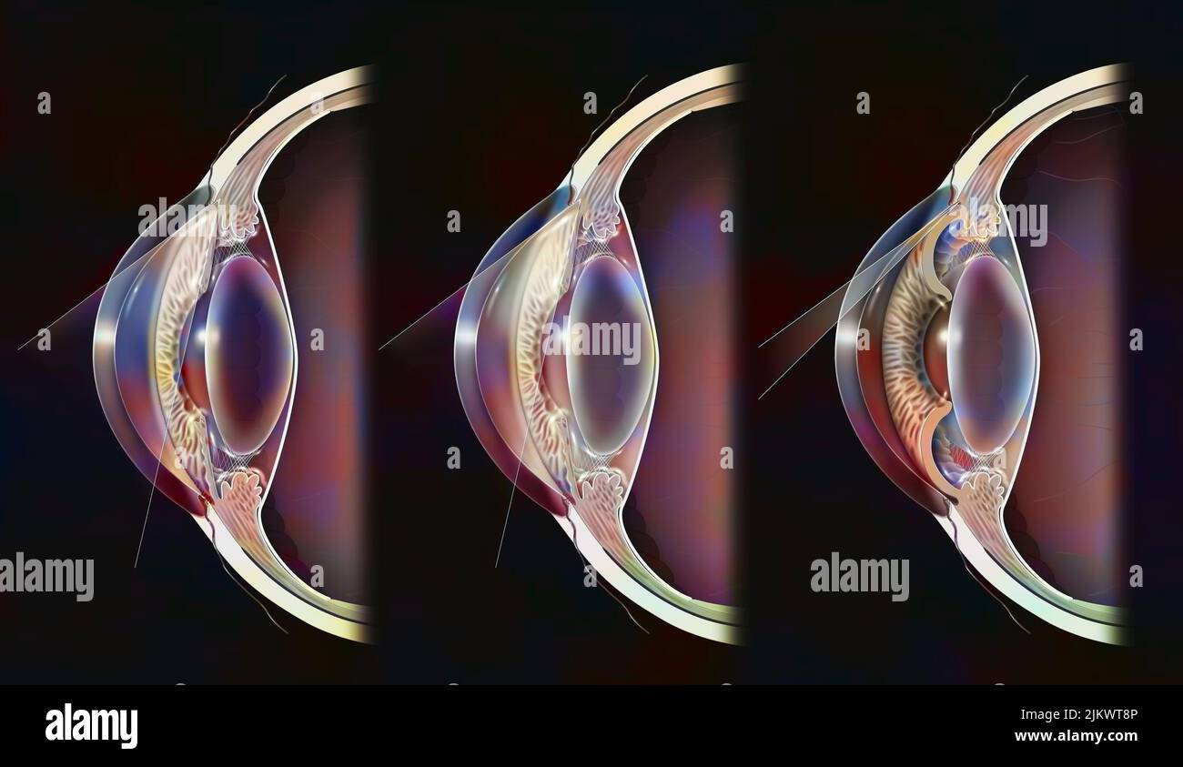 Confronto fotocamera immagini e fotografie stock ad alta risoluzione ...