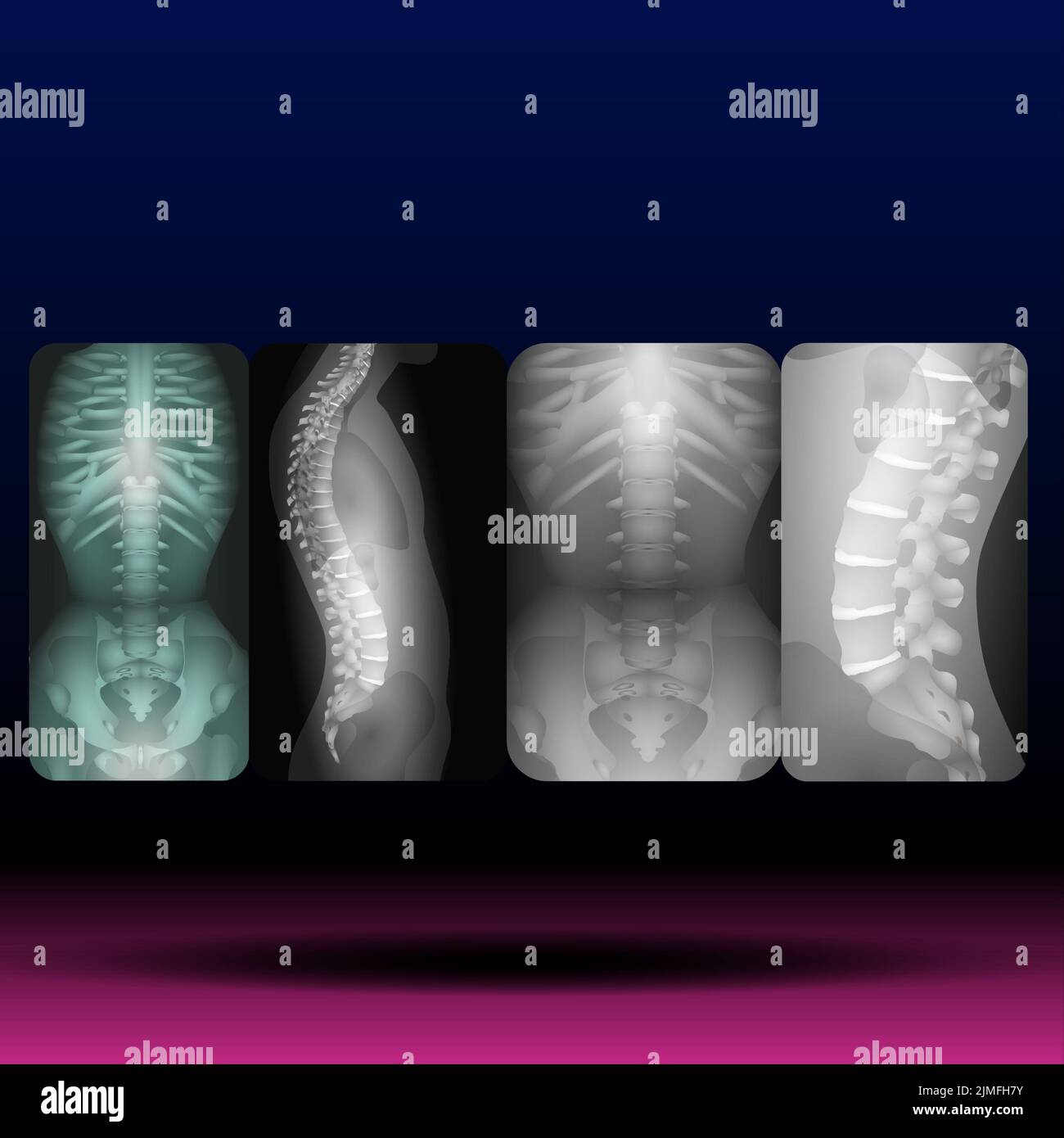 Colonna vertebrale lombare del film immagini e fotografie stock ad alta ...