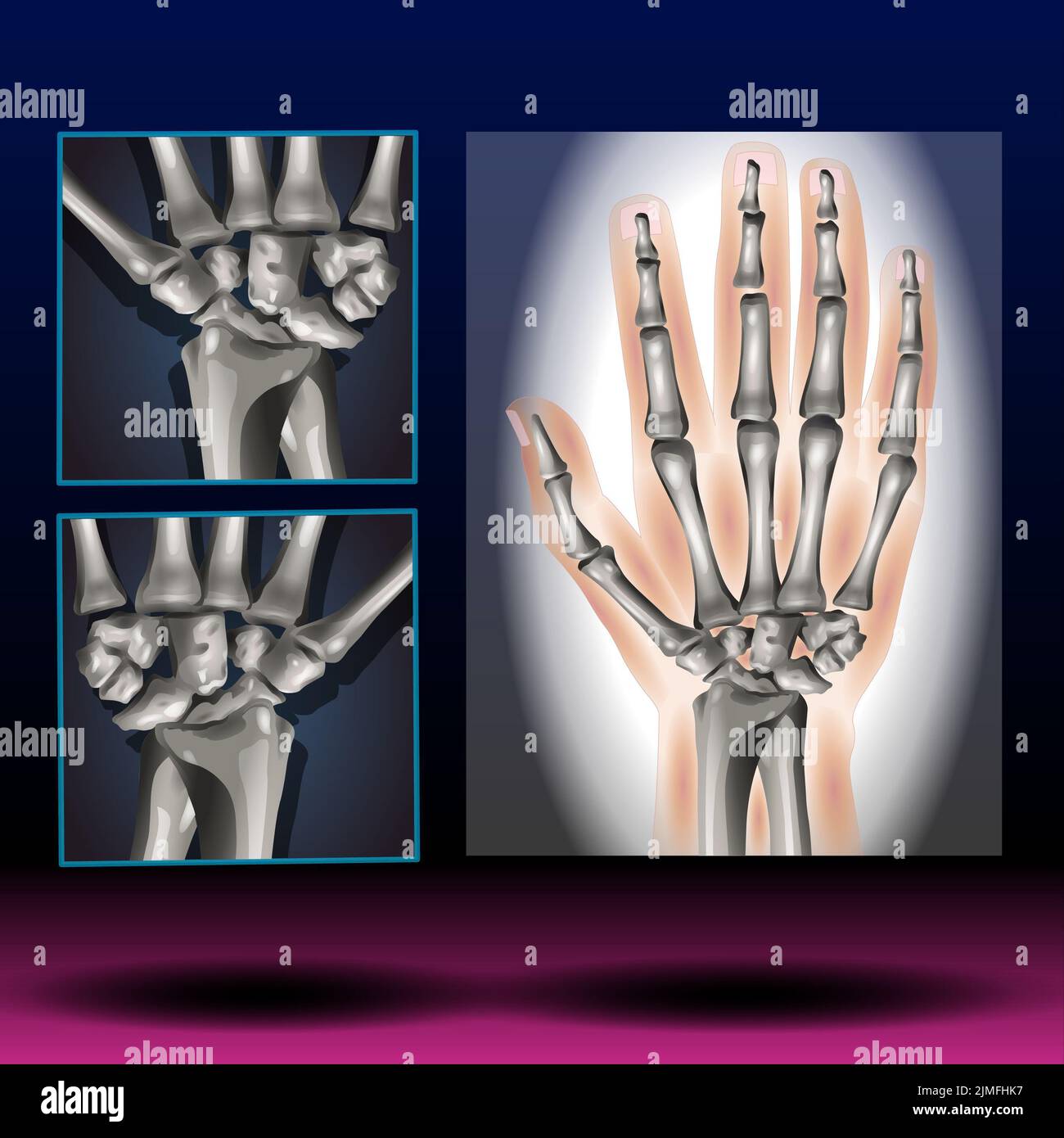 Anatomia dell'ulna immagini e fotografie stock ad alta risoluzione - Alamy
