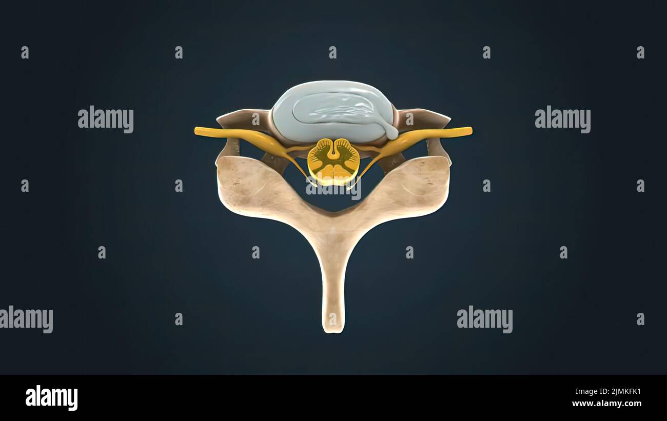 Vertebra lombar immagini e fotografie stock ad alta risoluzione - Alamy