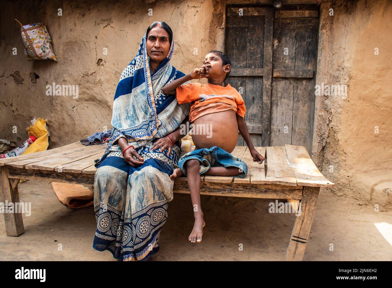 Distensione addominale immagini e fotografie stock ad alta risoluzione - Alamy