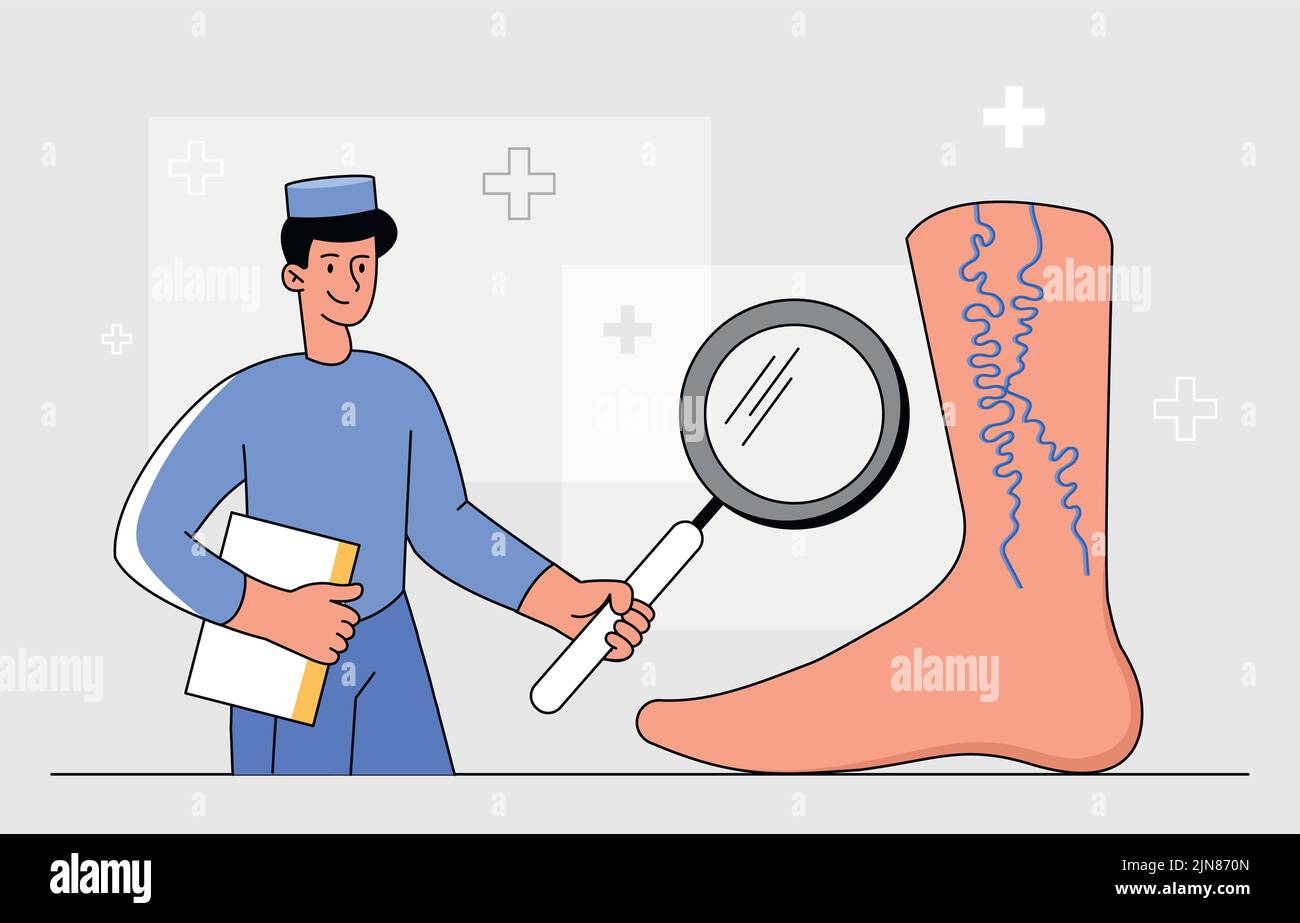 Thrombosis cartoon Immagini Vettoriali Stock - Alamy