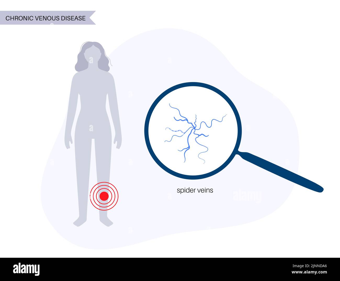 Diagramma a ragno immagini e fotografie stock ad alta risoluzione - Alamy