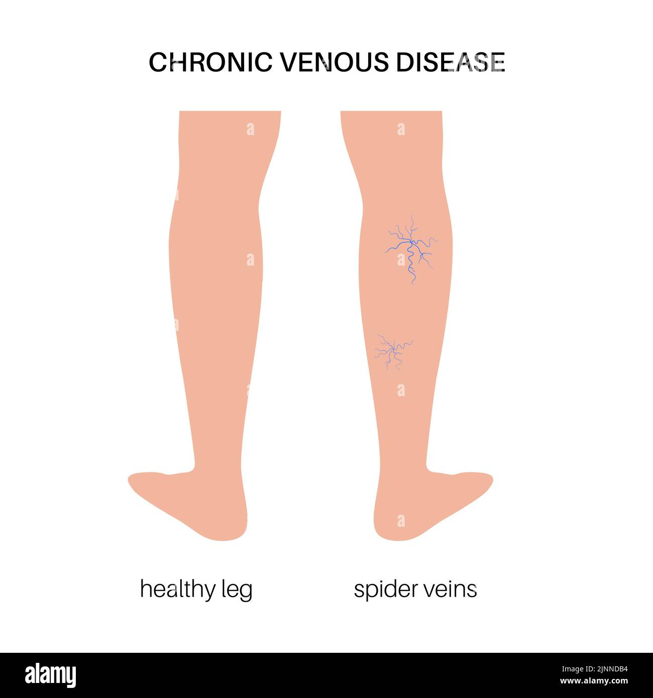 Diagramma a ragno immagini e fotografie stock ad alta risoluzione - Alamy