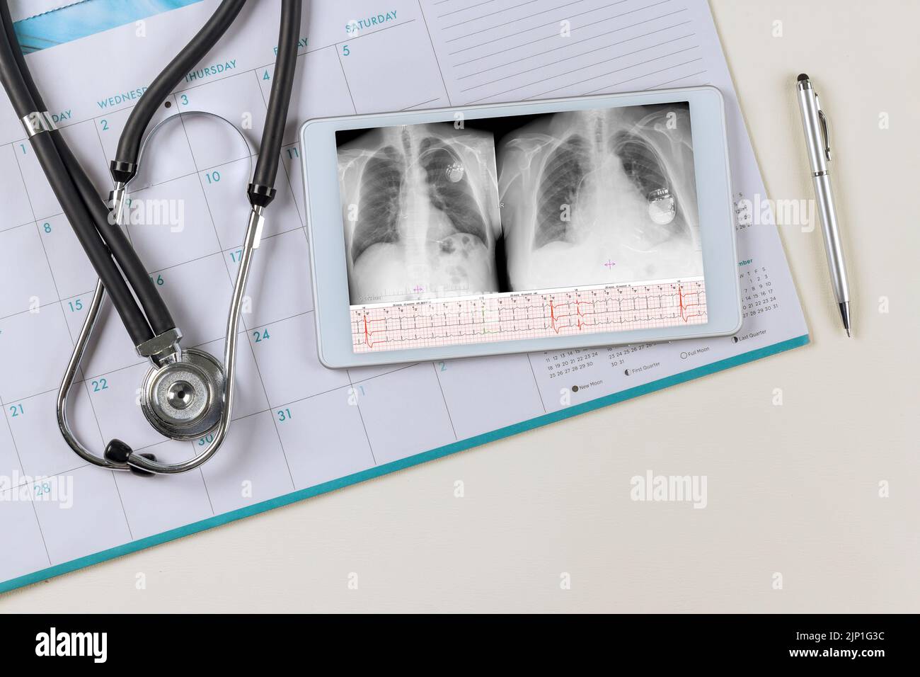 immagine radiologica, cardiologia, cardiogramma, pacemaker cardiaco ...