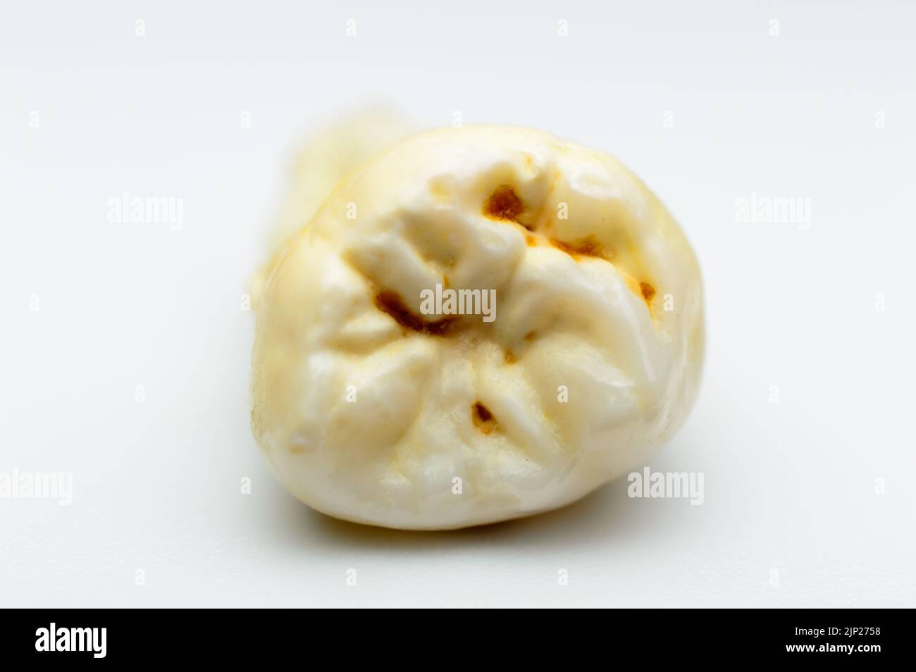 Radice del dente immagini e fotografie stock ad alta risoluzione - Alamy