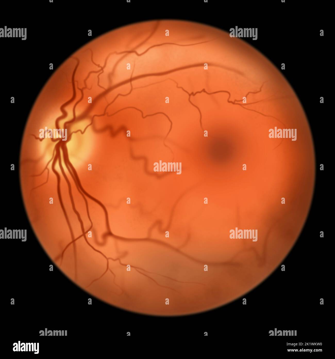 Retina del ojo humano immagini e fotografie stock ad alta risoluzione ...