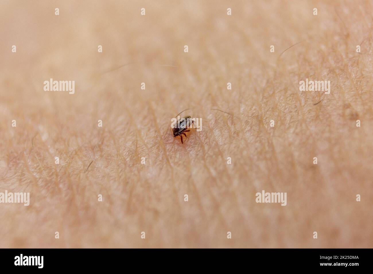 Pulce e zecca immagini e fotografie stock ad alta risoluzione - Alamy