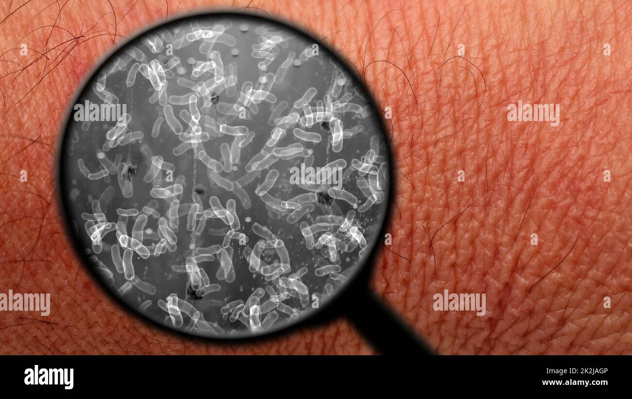 Pflege suchen immagini e fotografie stock ad alta risoluzione - Alamy