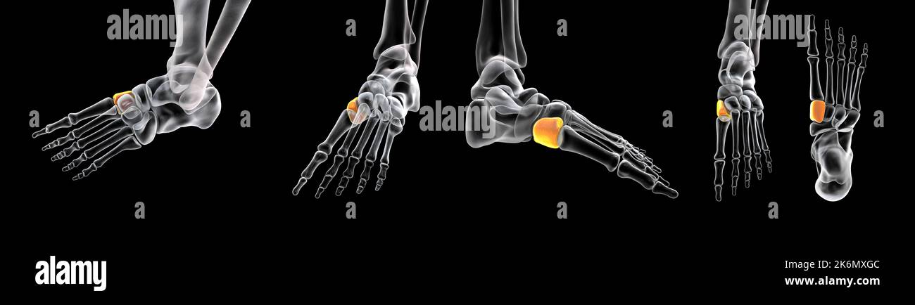 Primo cuneiforme immagini e fotografie stock ad alta risoluzione - Alamy