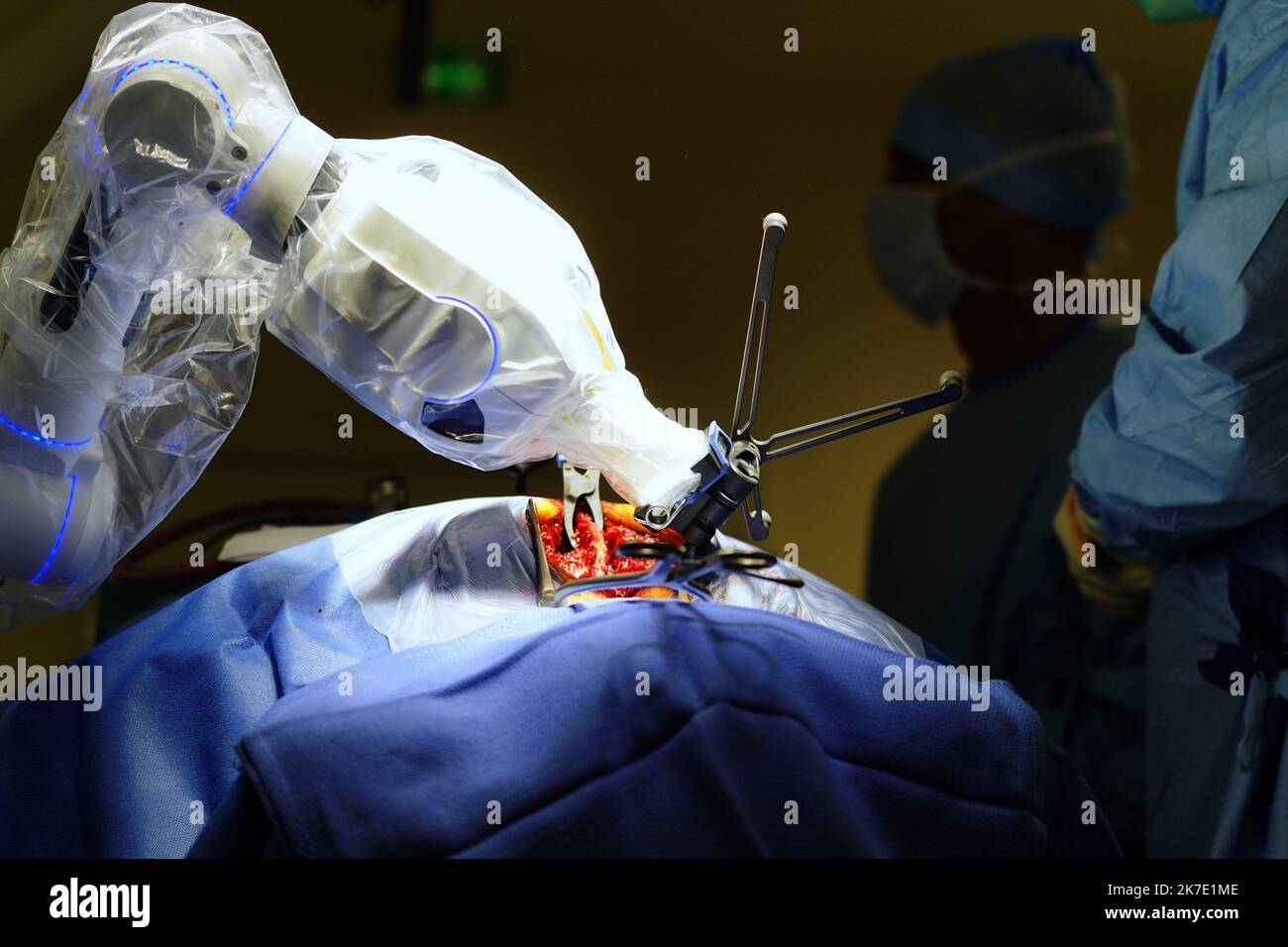 ©PHOTOPQR/OUEST FRANCE/Eddy LEMAISTRE ; ANGERS ; 01/06/2021 ; Chirurgie ...