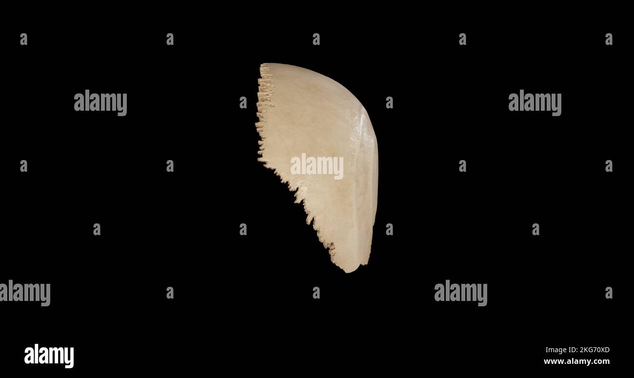 Fossa cranica posteriore immagini e fotografie stock ad alta ...