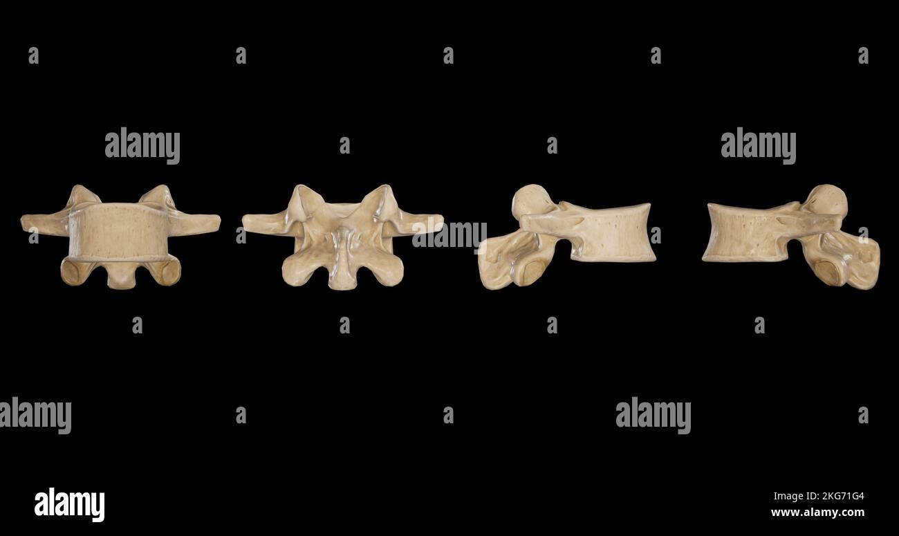 Lumbar vertebrae immagini e fotografie stock ad alta risoluzione - Alamy