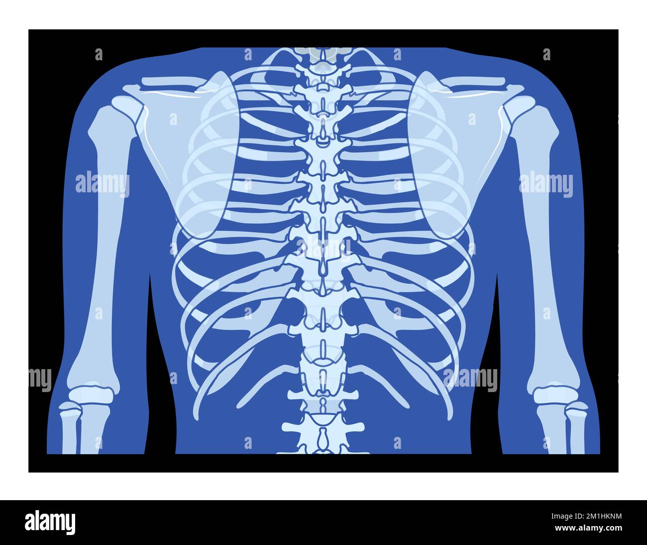 Gabbia toracica ct Immagini Vettoriali Stock - Alamy