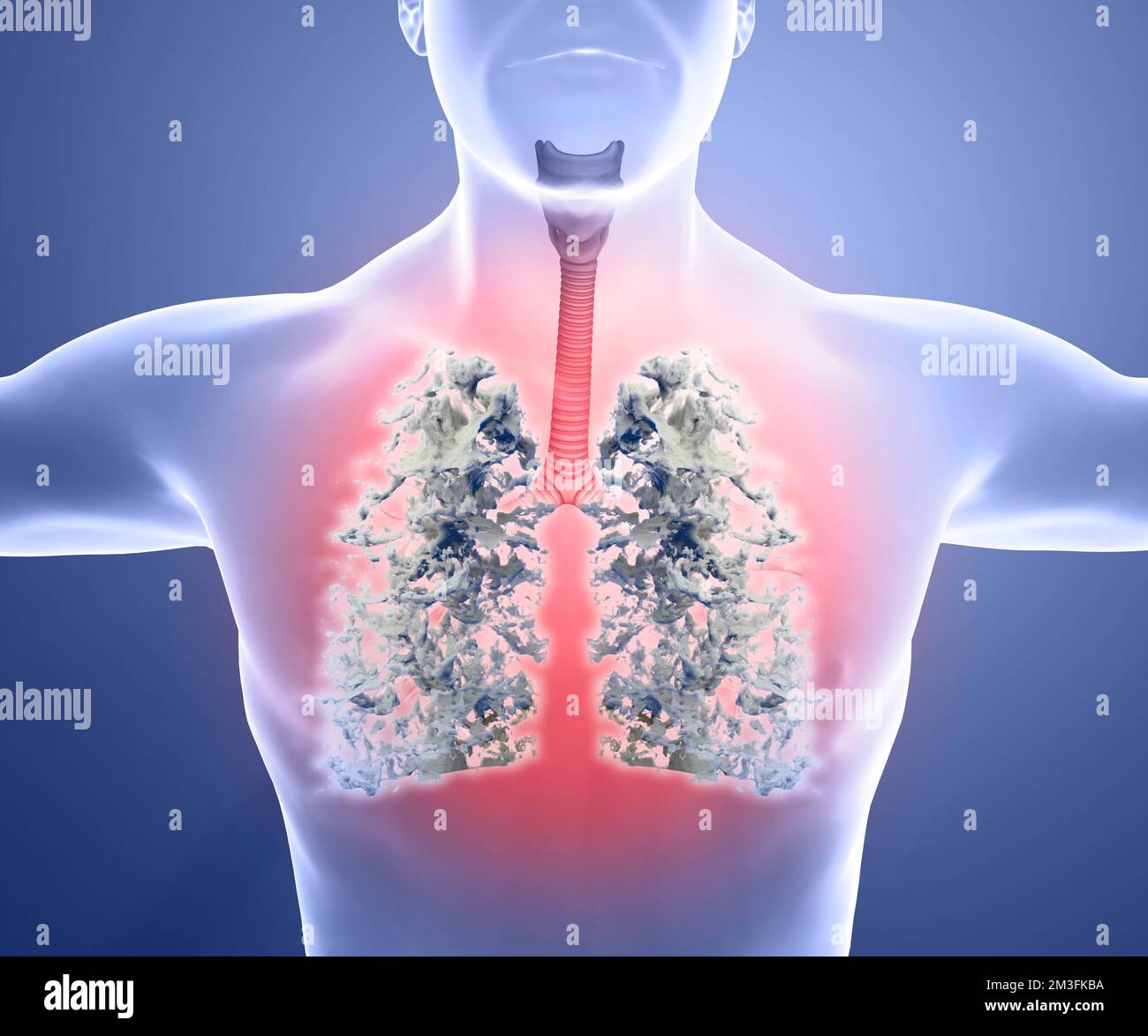 Anatomia umana, problemi con il sistema respiratorio, polmoni ... Anatomia umana, problemi con il sistema respiratorio, polmoni ...