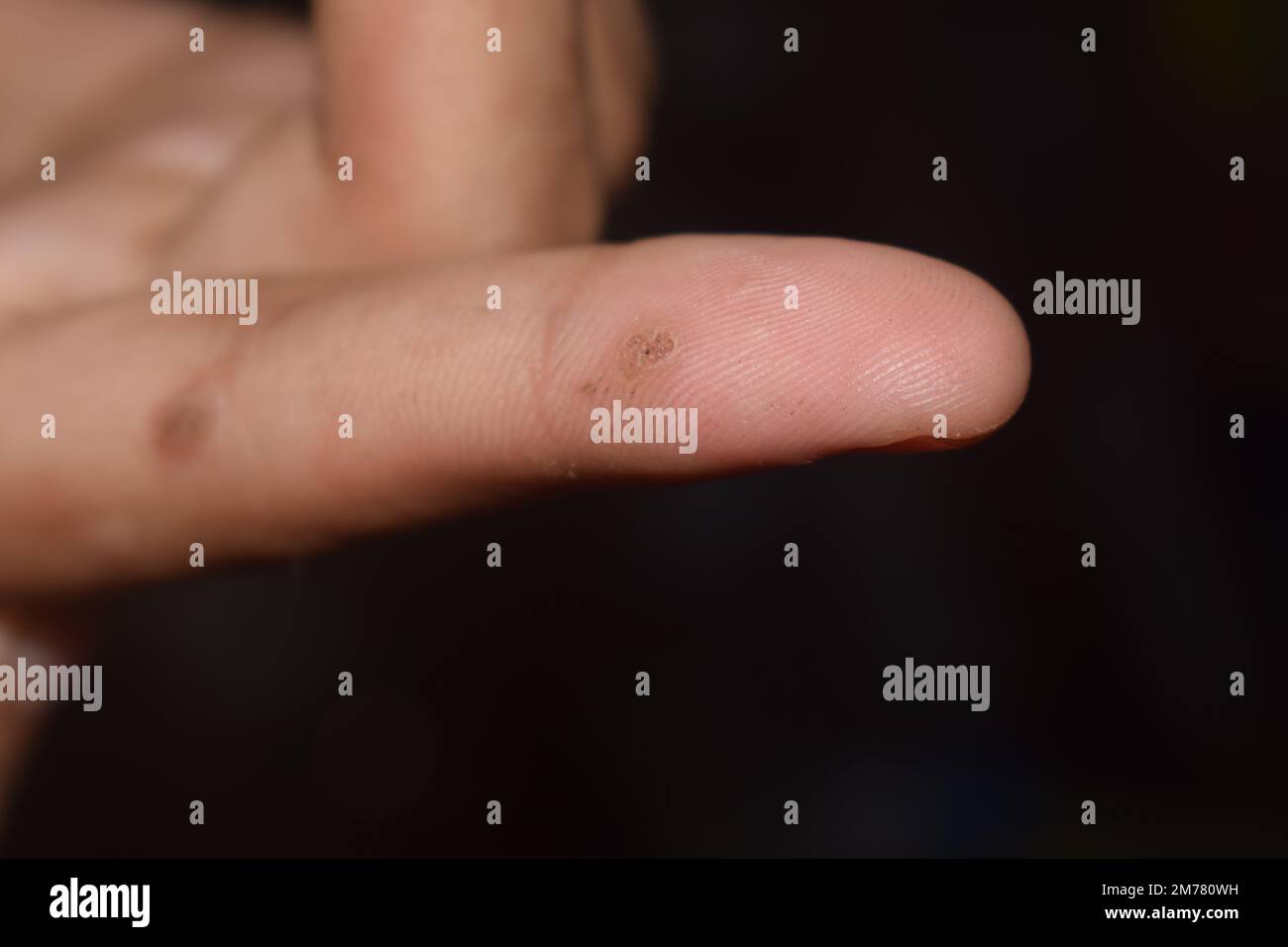 Verruche e tutto immagini e fotografie stock ad alta risoluzione - Alamy
