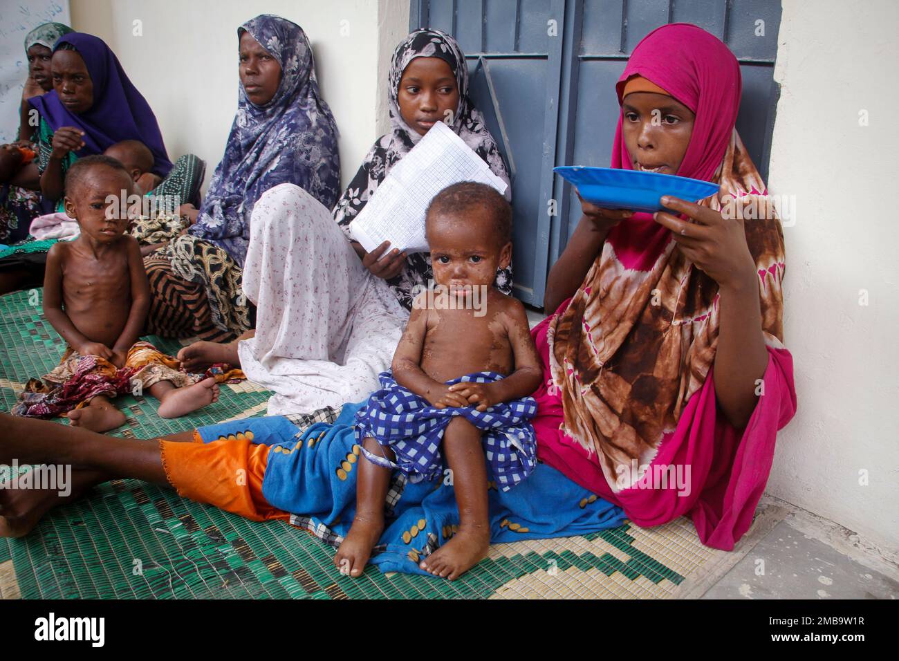 Somali children displaced by drought and showing symptoms of ...
