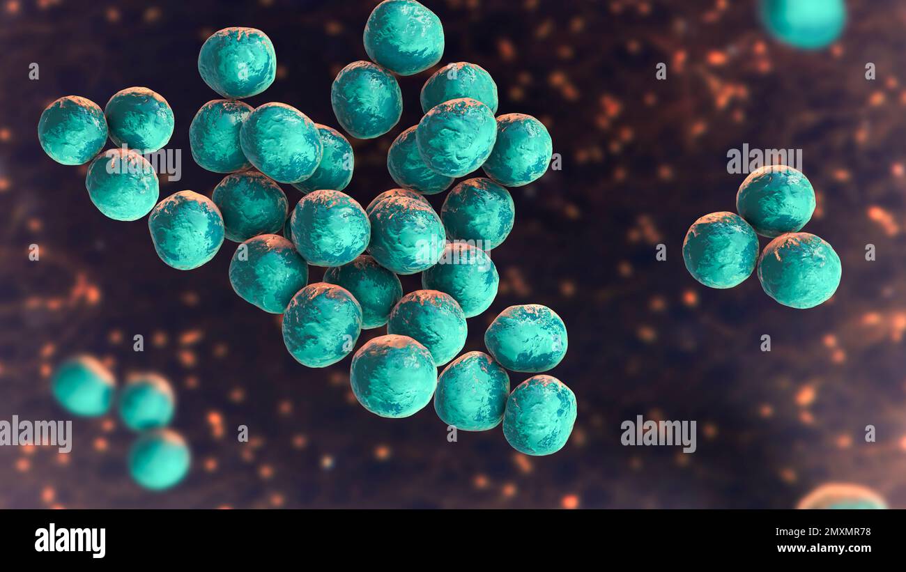 Infezioni cutanee da stafilococco immagini e fotografie stock ad alta risoluzione - Alamy