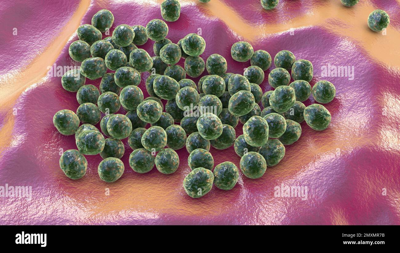 Infezioni cutanee da stafilococco immagini e fotografie stock ad alta risoluzione - Alamy